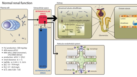 Aetiology and management of acute kidney injury in multiple myeloma