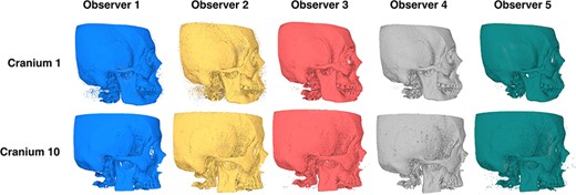 Sex Estimation From Virtual Models Exploring The Potential Of
